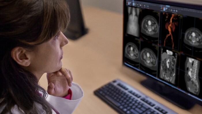 IntelliSpace Cardiovascular | Philips