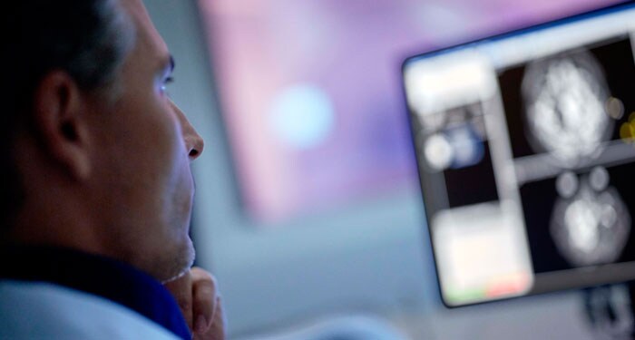 Compressed SENSE Brain | Philips