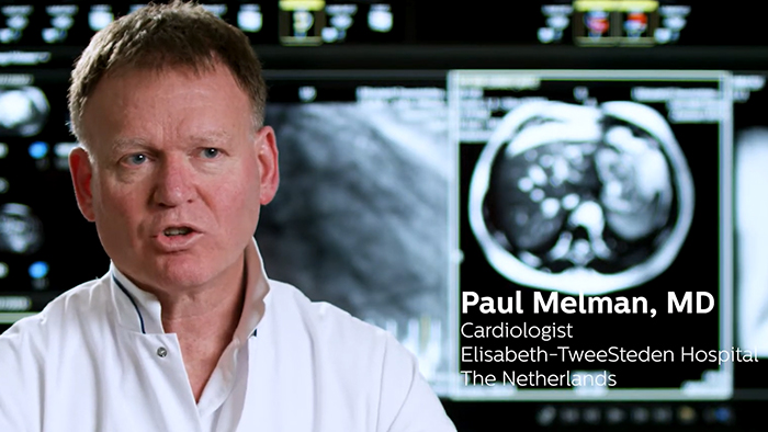 IntelliSpace Cardiovascular | Philips